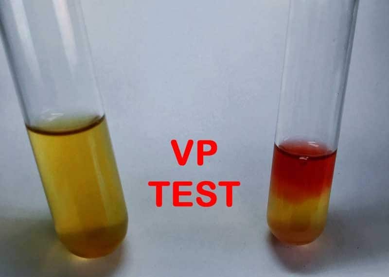 Solved Record Your Color Observations Of The MR-VP, 58% OFF